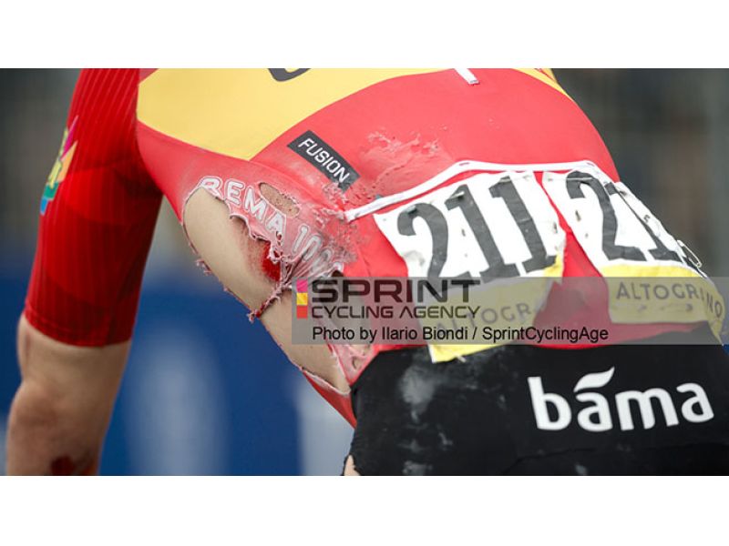 CADUTO AL GIRO, BLIKRA HA PEDALATO 10 GIORNI CON QUATTRO FRATTURE